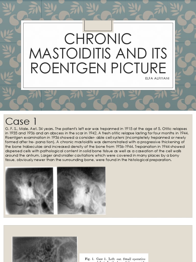 Chronic Mastoiditis and Its Roentgen Picture | PDF | Anatomy | Medicine