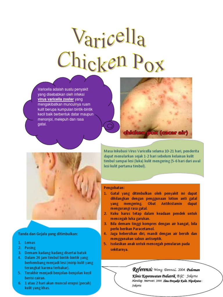 Poster Varicella Final | PDF