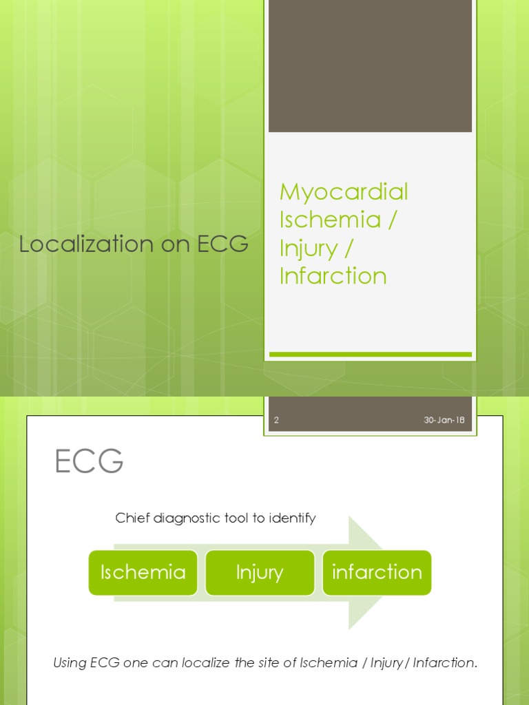 Localization On ECG: Myocardial Ischemia / Injury / Infarction | PDF ...
