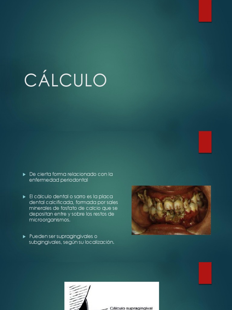 Cálculo Periodoncia | PDF | Diente | Las bacterias