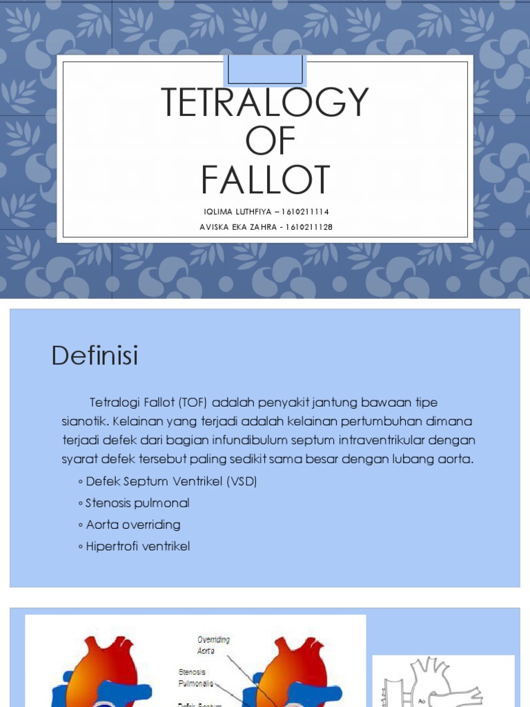 Tetralogy of Fallot | PDF