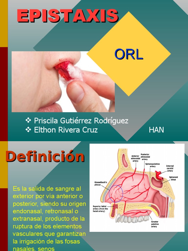 Epistaxis | PDF | Otorrinolaringología | Medicina