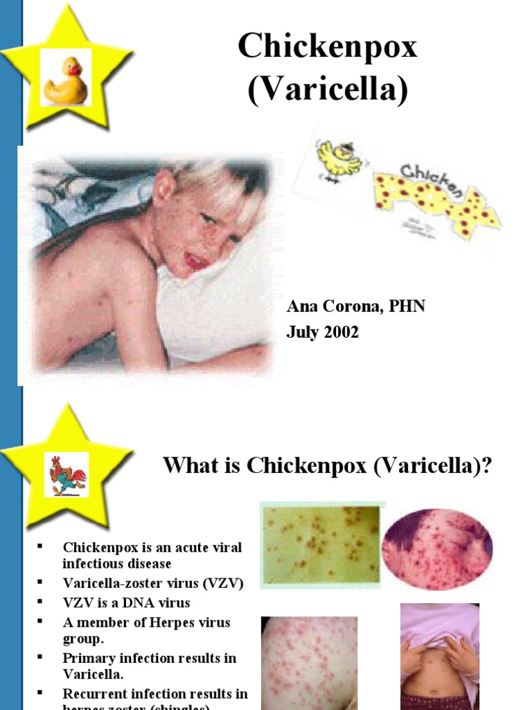 Chickenpox Presentation 1209266936137555 9 | PDF | Vaccines | Health ...