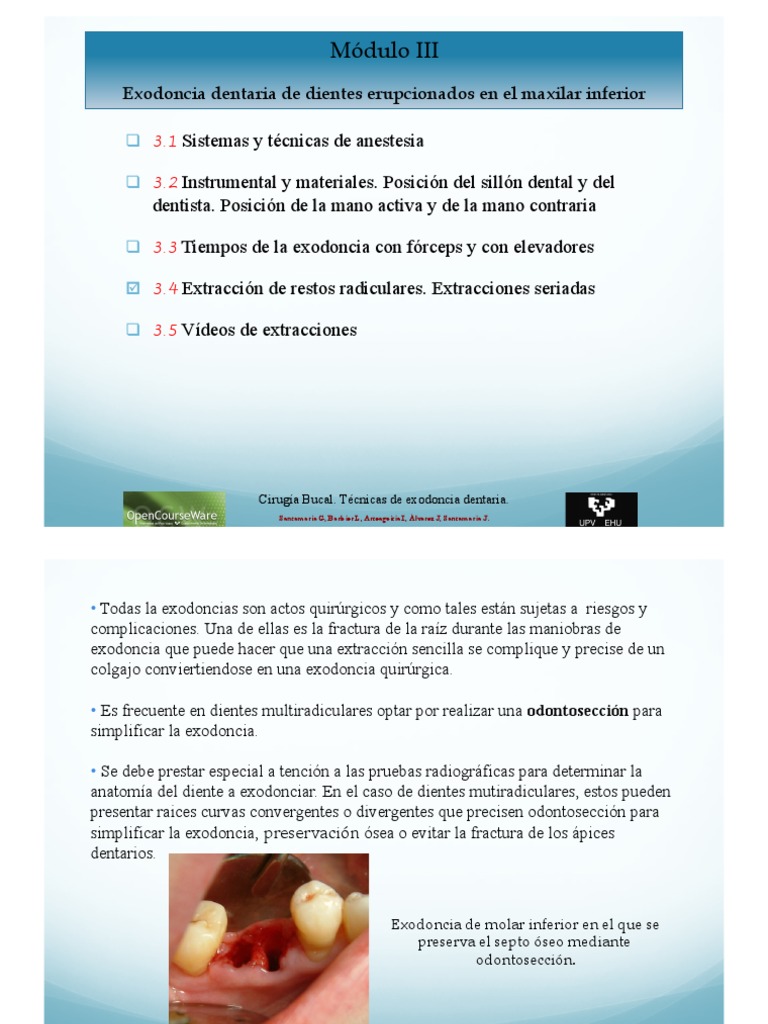3.4 Extraccion de Restos Radiculares. Extracciones Seriadas | PDF ...
