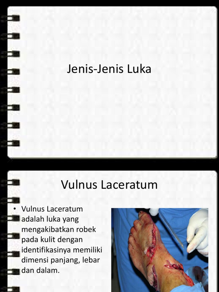 Jenis Jenis Luka | PDF