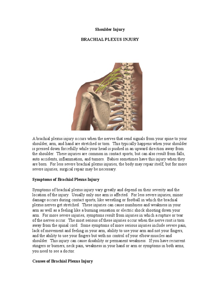 Shoulder Injury Brachial Plexus Injury | PDF | Shoulder ...