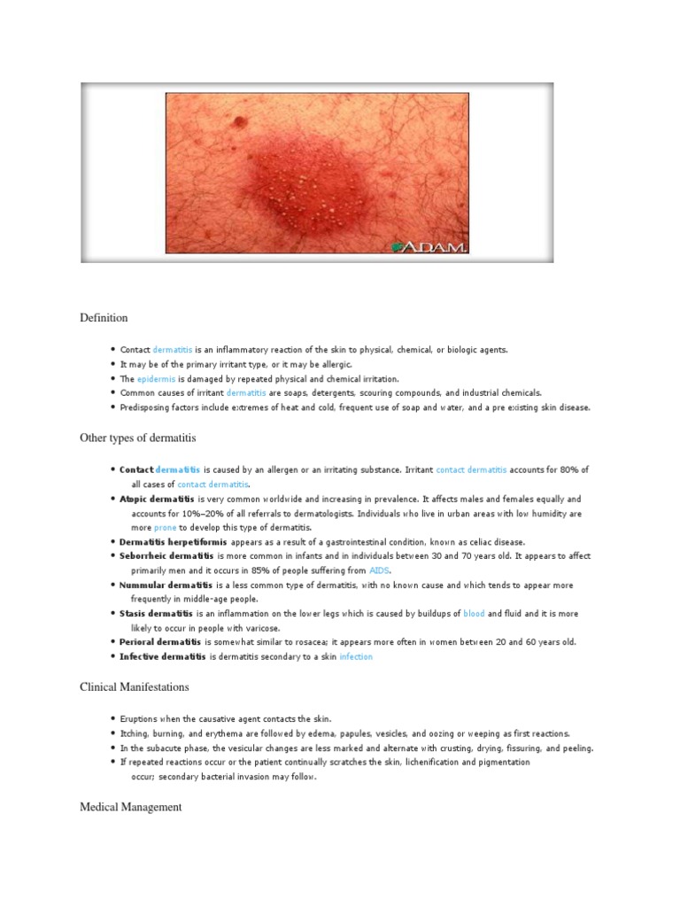 Contact Dermatitis | Dermatitis | Dermatology