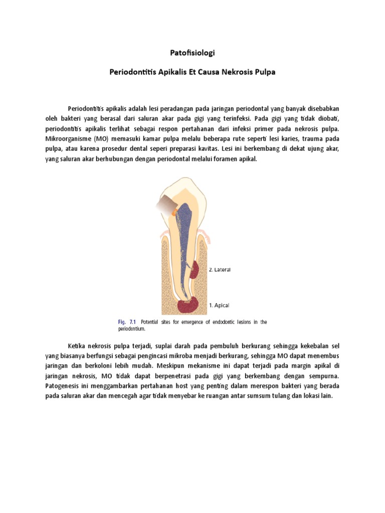 Patofisiologi Periodontitis Apikalis | PDF