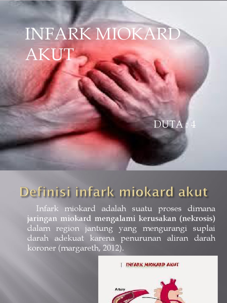 Infark Miokard Akut | PDF