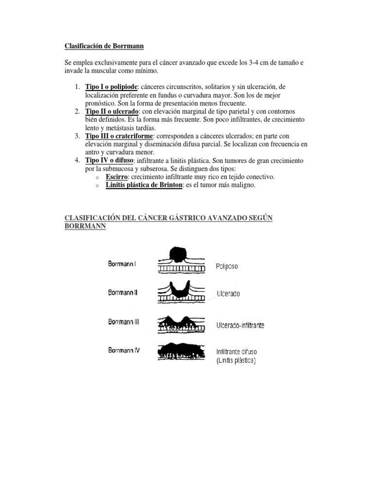 Clasificación de Borrmann en cáncer gástrico | PDF