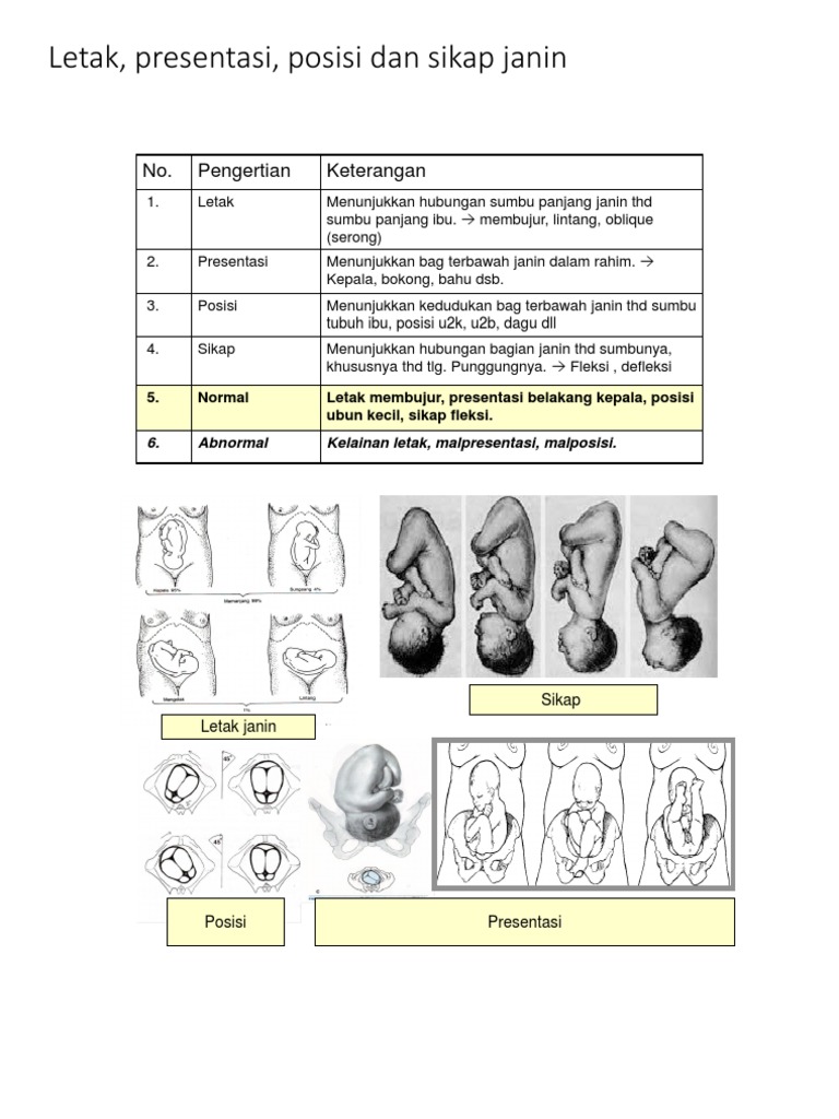 Malpresentasi, Malposisi & Indikasi SC | PDF
