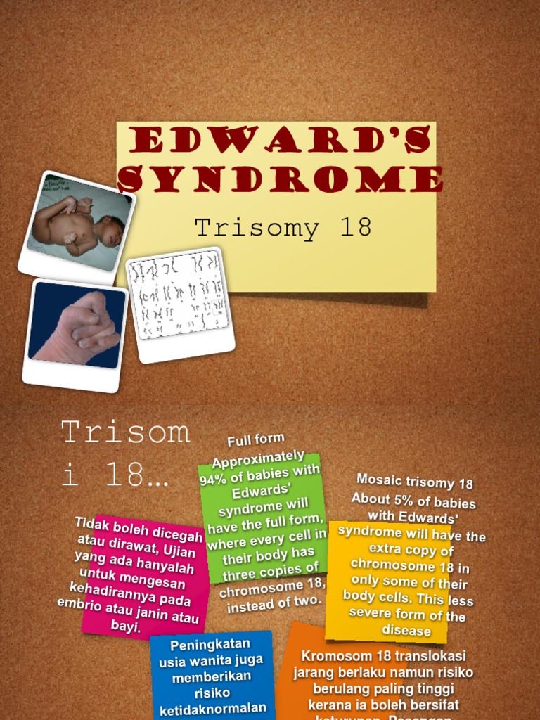 Understanding Trisomy 18: Symptoms, Causes, and Risk of Recurrence in ...
