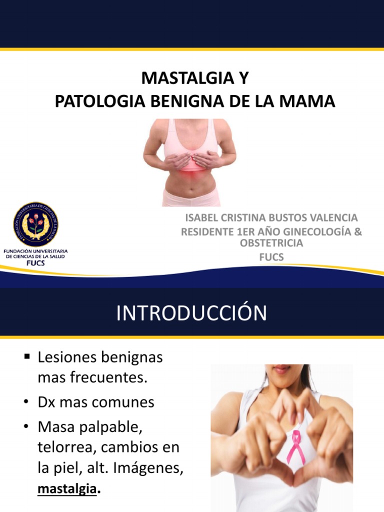 Mastalgia | PDF | Cáncer de mama | Salud sexual