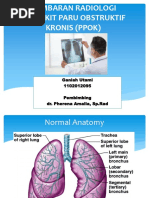 Anatomi Thorax Normal + Gambaran Radiologi | PDF