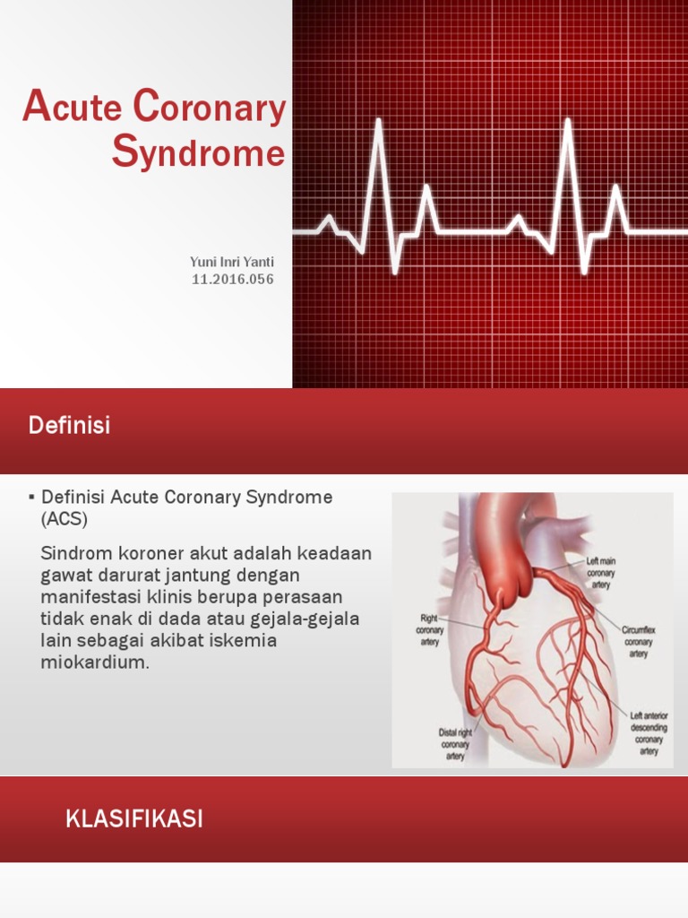 Referat Jantung ACS | PDF