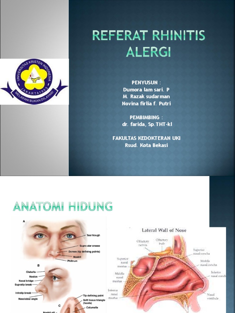 Referat Rhinitis Alergi | PDF