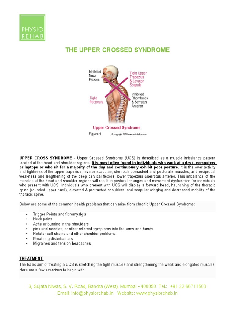 Upper Cross Syndrome | Shoulder | Dance Science