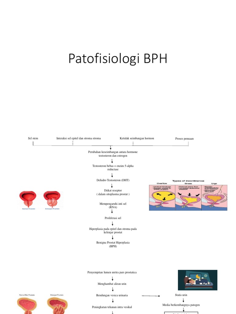 Patofisiologi BPH | PDF