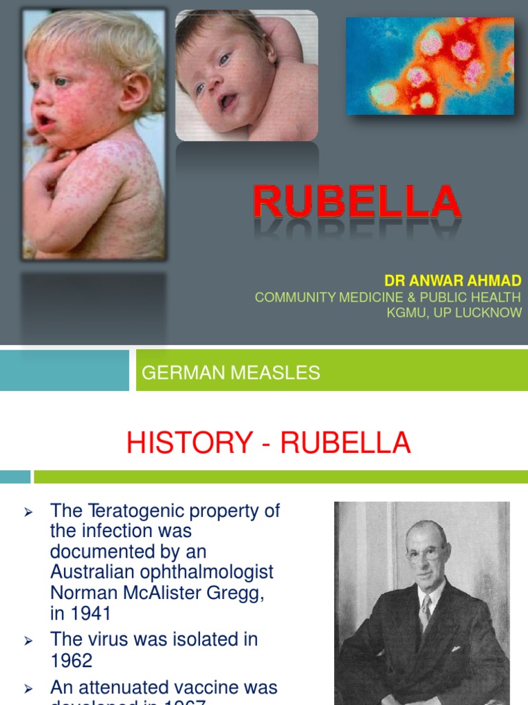 Rubella | PDF | Health Sciences | Immunology