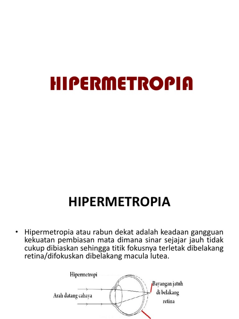 Hipermetropia | PDF
