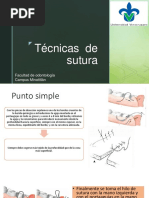 Punto Simples | PDF | Sutura Quirúrgica