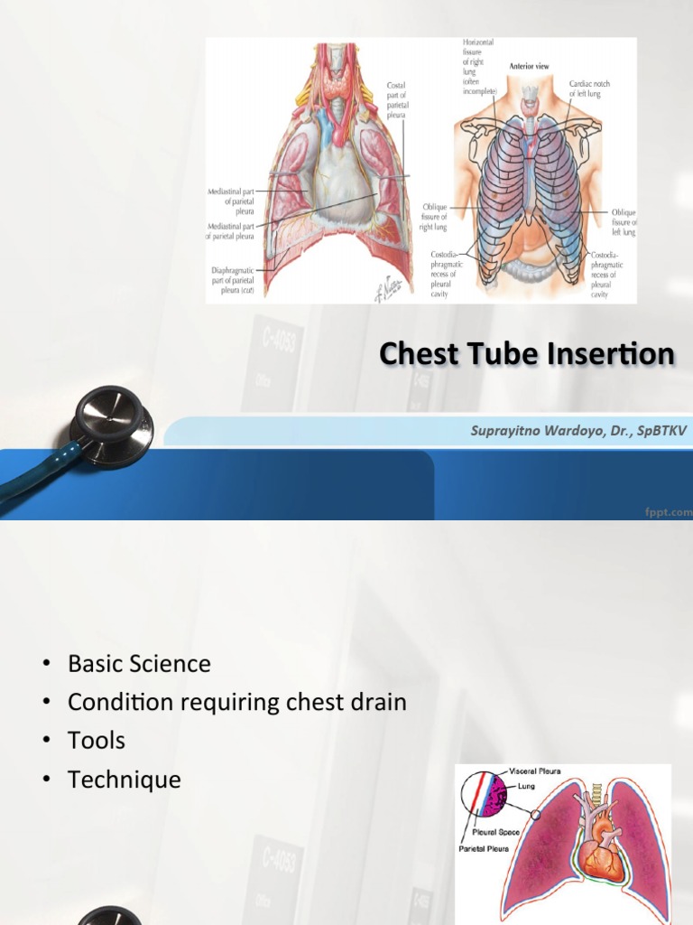 Chest Tube Insertion | PDF | Thorax (Human Anatomy) | Respiratory System