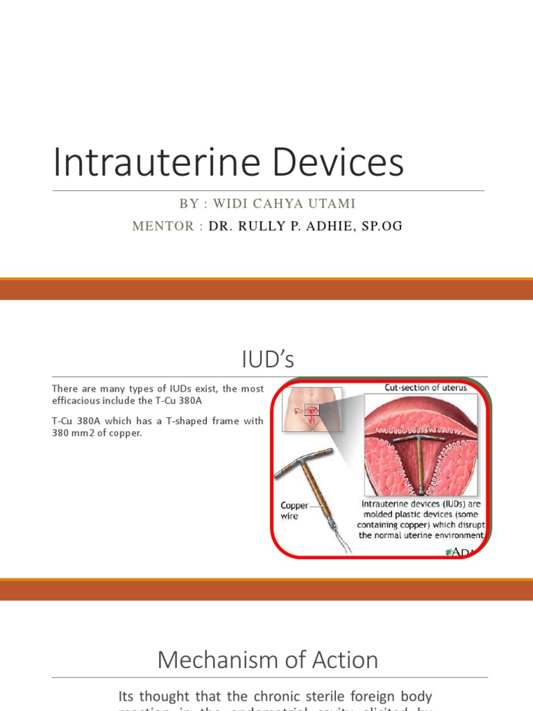 Intrauterine Devices: By: Widi Cahya Utami Mentor | PDF | Wellness ...