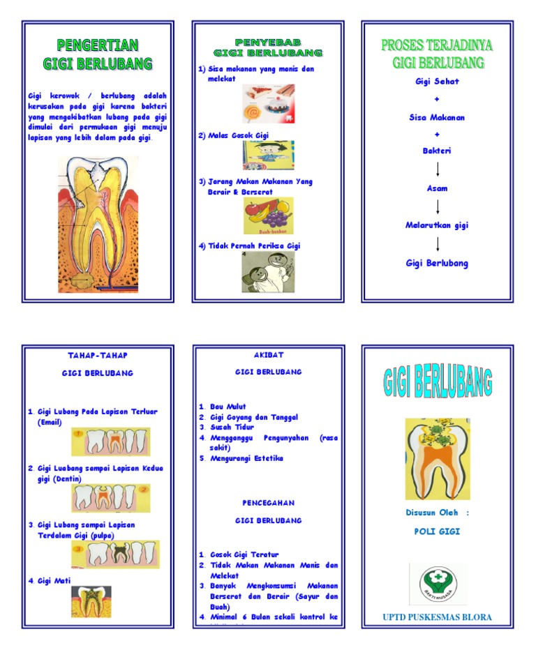 Proses Gigi Berlubang | PDF