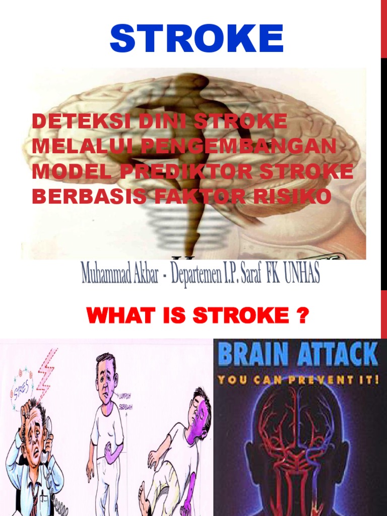 Stroke: Deteksi Dini Stroke Melalui Pengembangan Model Prediktor Stroke ...