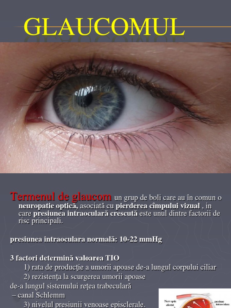 Glaucom | PDF