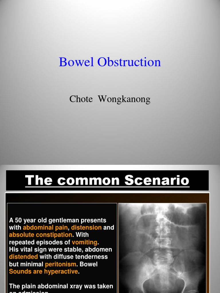 Bowel Obstruction | PDF | Large Intestine | Gastroenterology