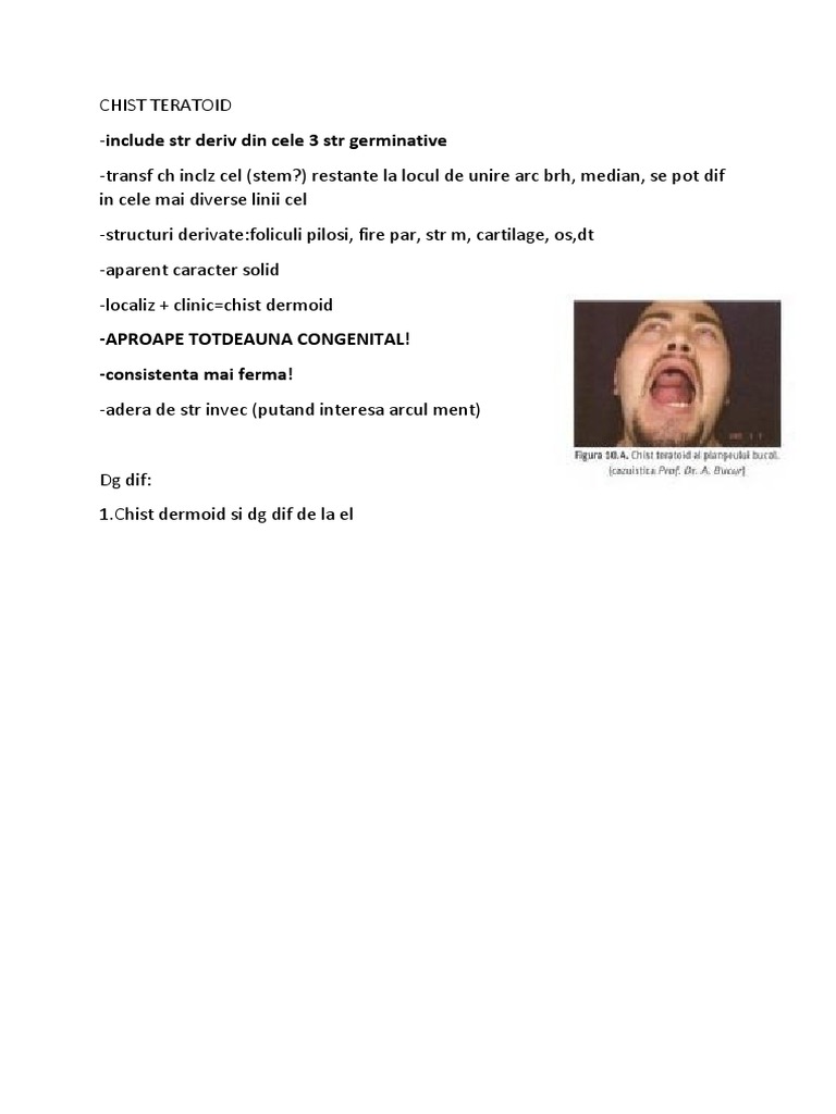 Chist Teratoid | PDF | History