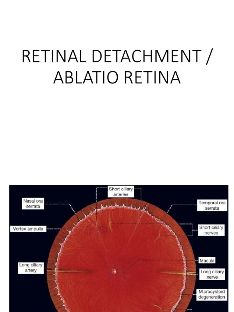 Ablatio Retina Dr. Yanuar SP.M | PDF | Epidemiology | Vision
