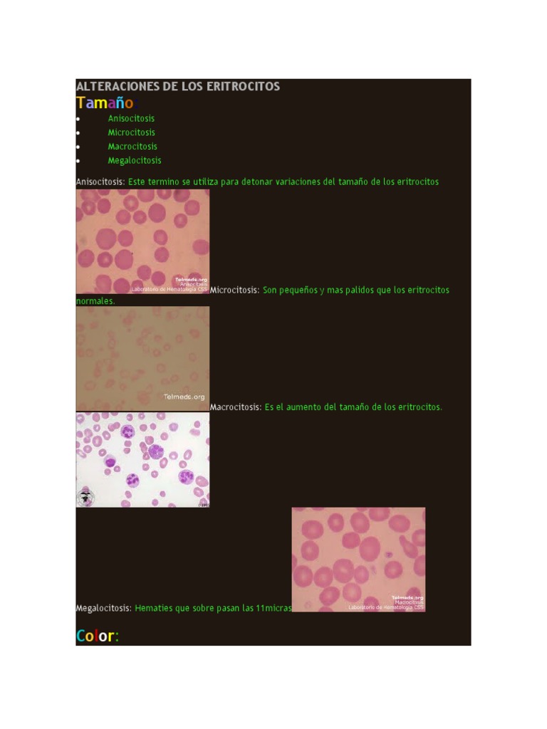 Alteraciones de Los Eritrocitos | PDF | Enfermedad de célula falciforme ...
