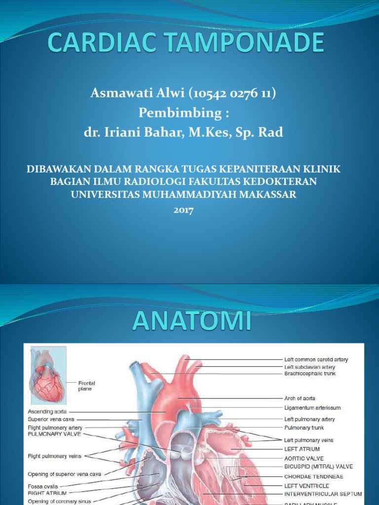 Cardiac Tamponade | PDF