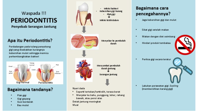 Leaflet Periodontitis PJK | PDF