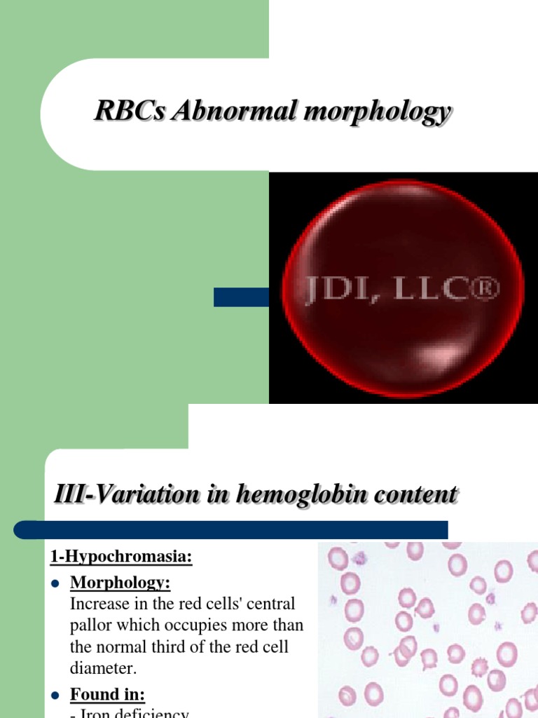 Rbcs Abnormal Morphology: Mohammed Laqqan | PDF | Anemia | Red Blood Cell