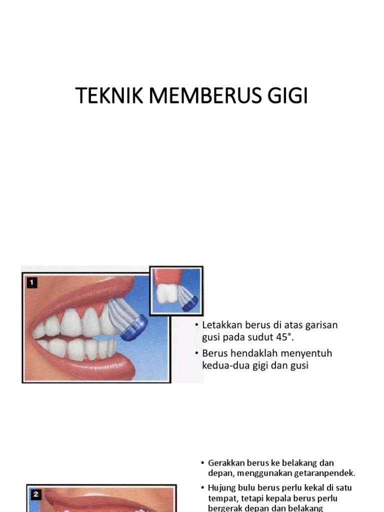 Teknik Memberus Gigi | PDF