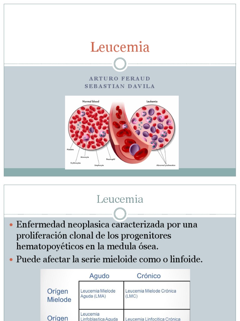 Guía Completa sobre Leucemia | PDF | Leucemia | Especialidades Medicas