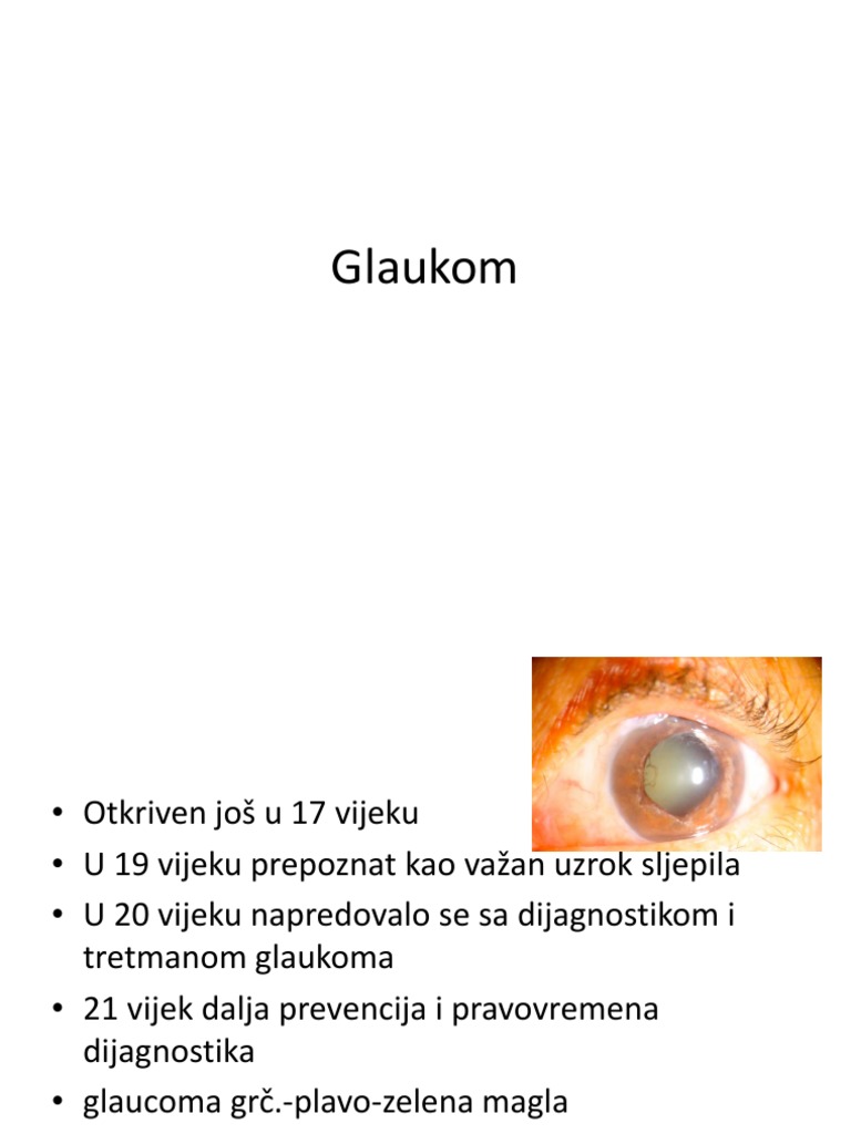 Glaukom | PDF
