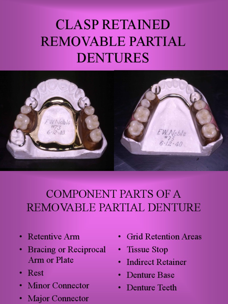 Component Parts RPD-1 | PDF | Dentures | Animal Anatomy