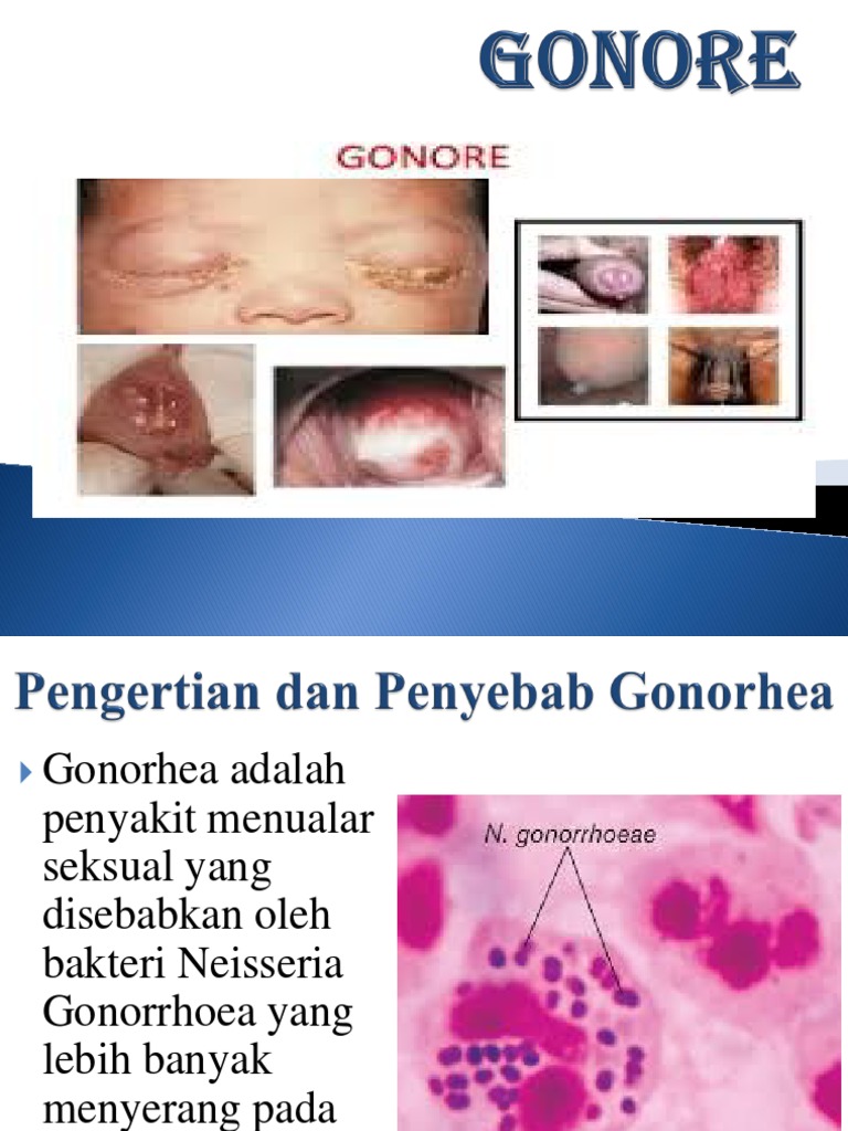 GONORE | PDF