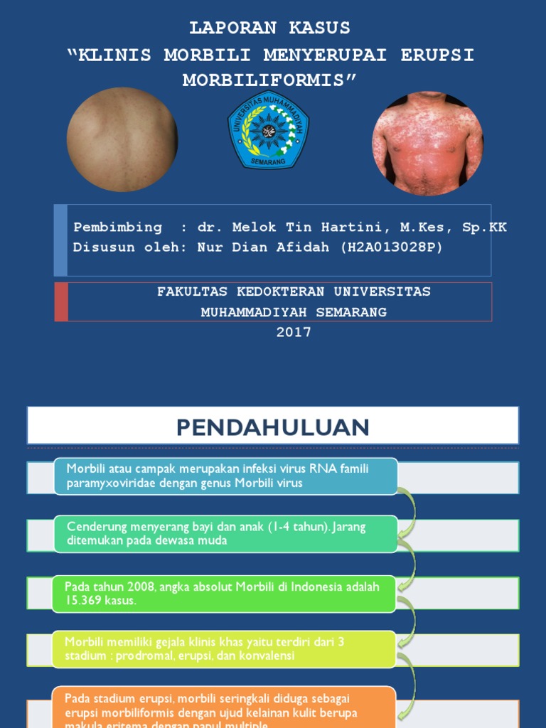 Klinis Morbili Menyerupai Eruspsi Morbiliformis | PDF