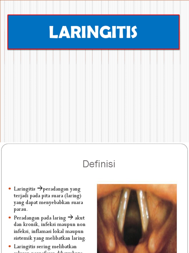 Laringitis Akut | PDF