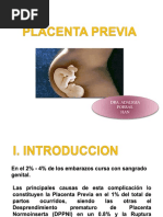 Distocia Funicular | PDF | Parto | Feto