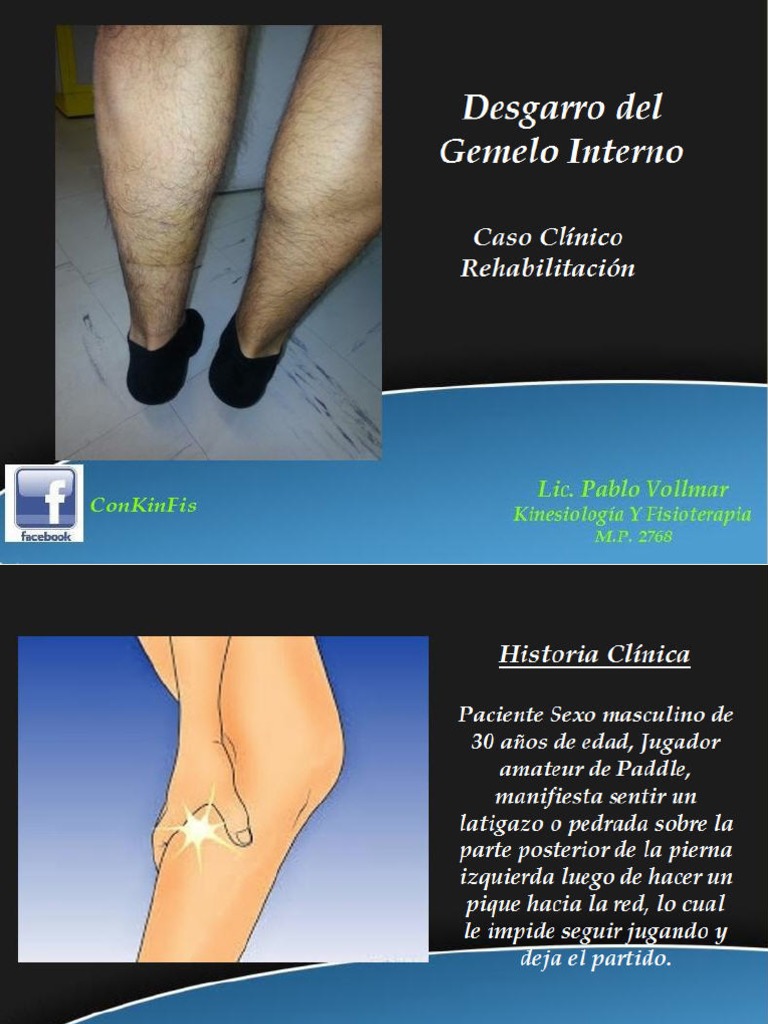 Desgarro de Gemelo Interno | PDF