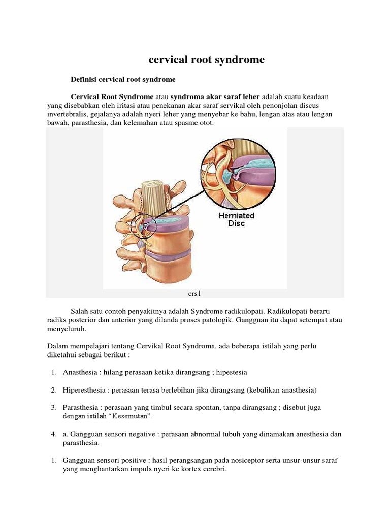 Cervical Root Syndrome | PDF