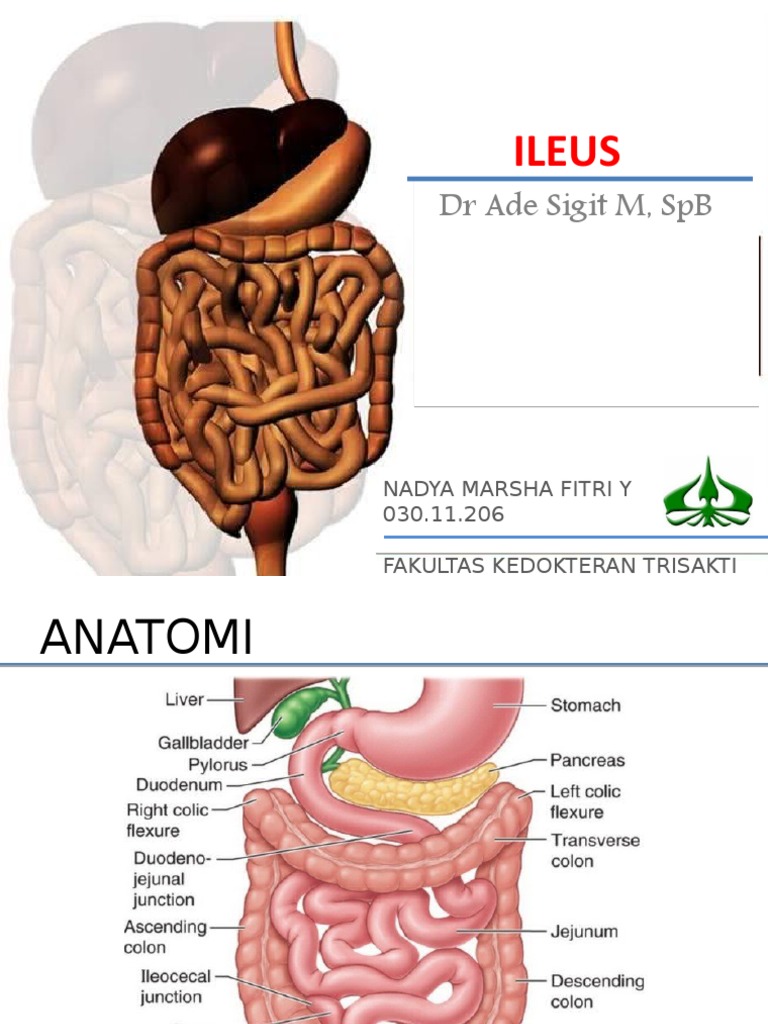Ileus Final | PDF | Sains & Matematika