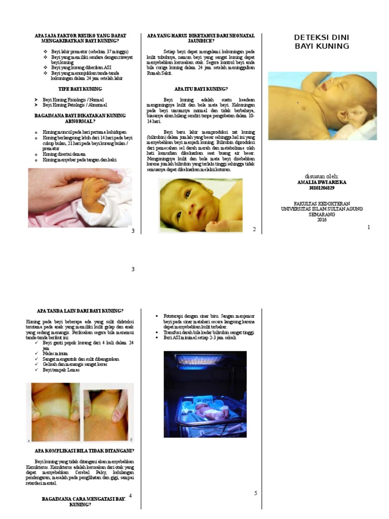 Leaflet Penyuluhan Neonatal Jaundice | PDF