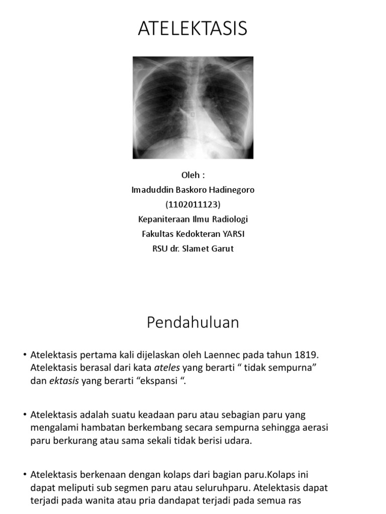 Atelektasis Paru: Penyebab, Gejala Klinis, Diagnosis dan ...